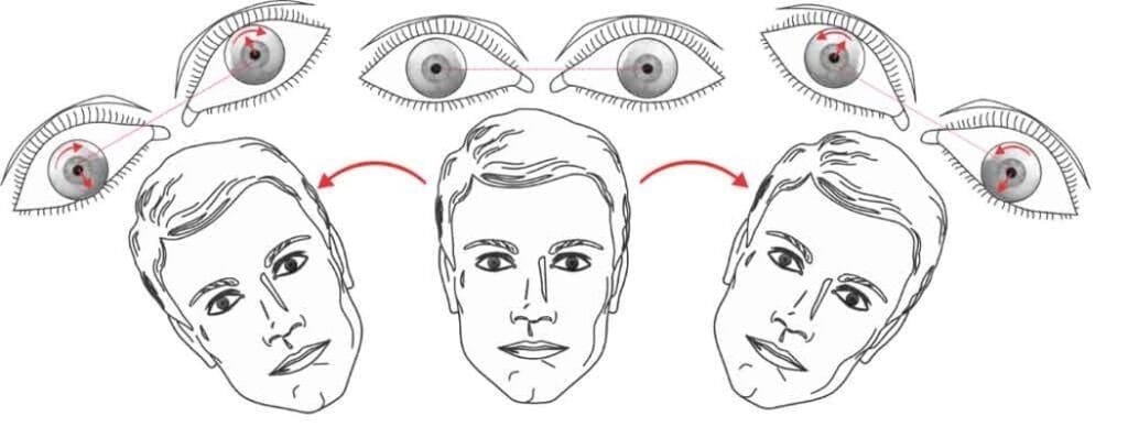Ocular Counter-Roll Test | Akdeniz Vertigo Merkezi